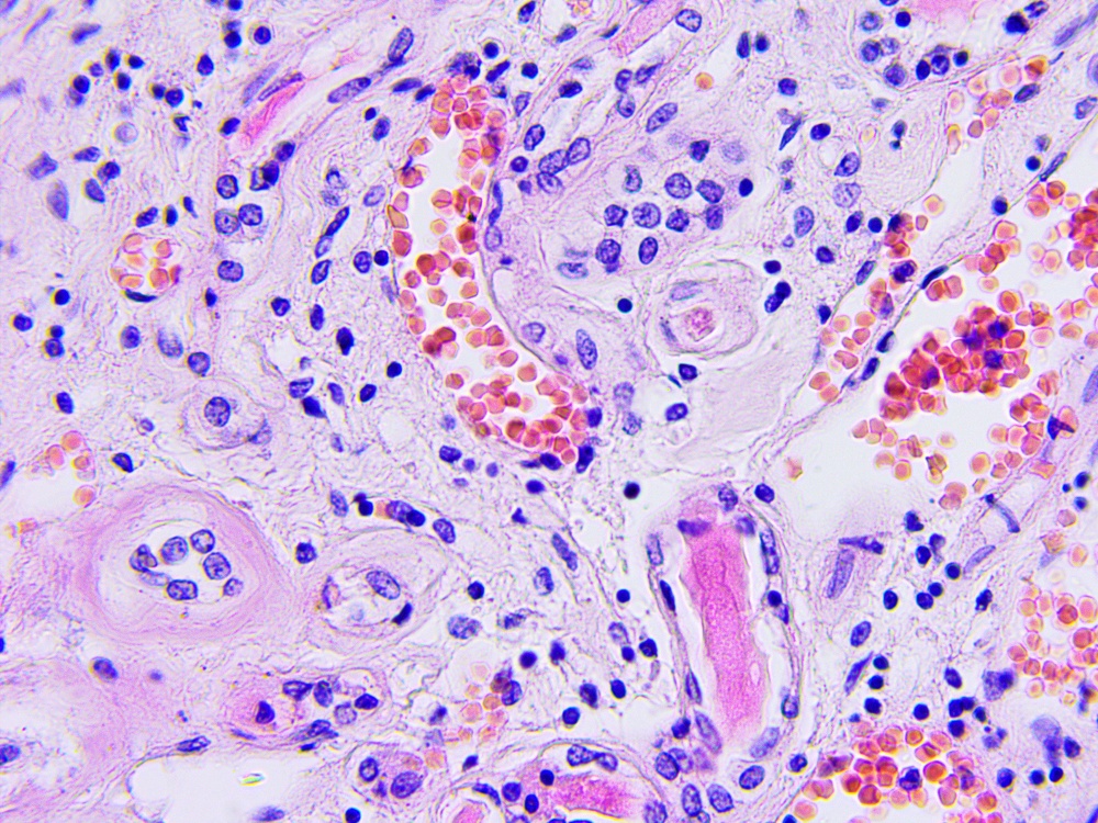 Spatial biology: a new era of discovery - The Blog - Tecan