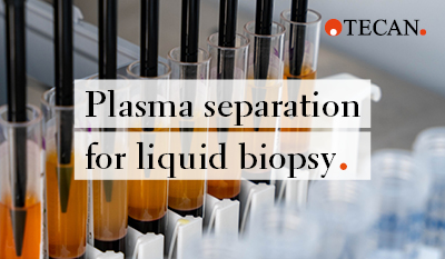 Tecan - Phase Separator