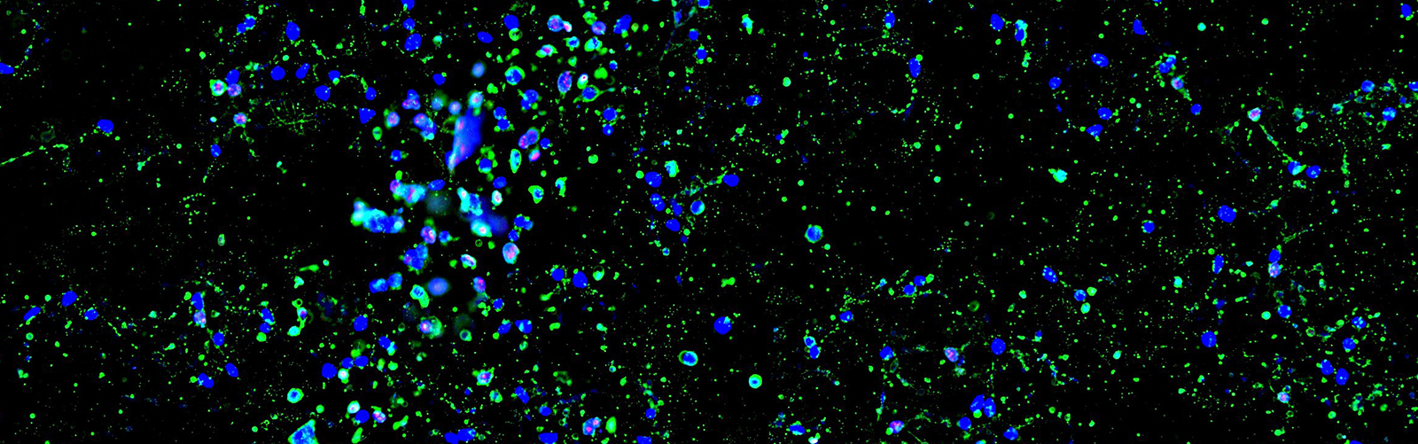 Spark Cyto DEMO - Never miss a critical biological event!